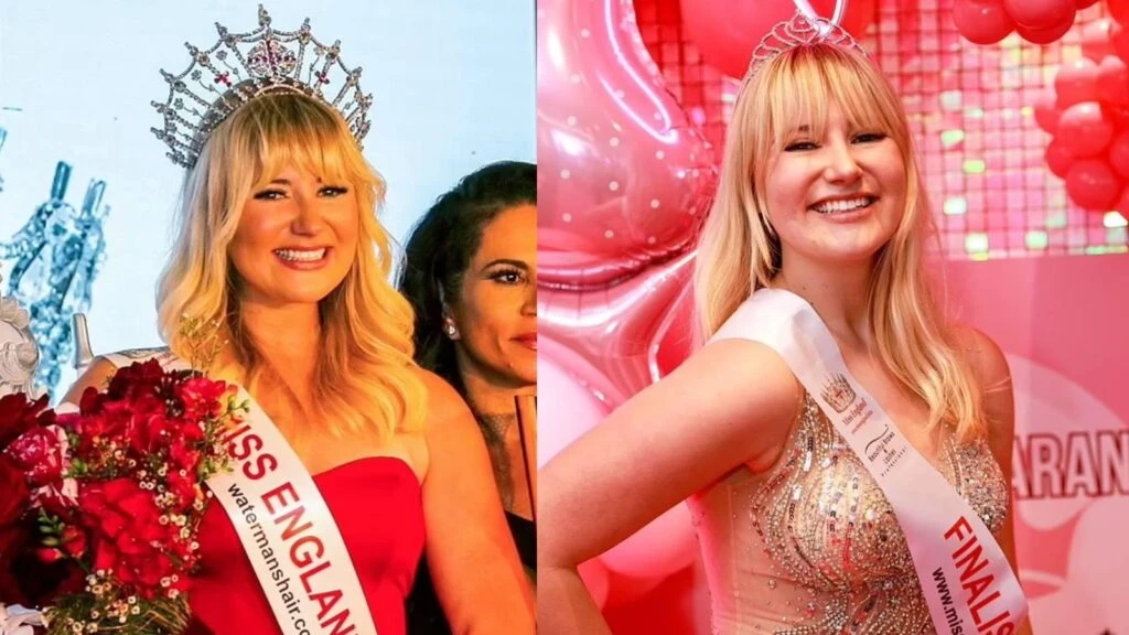Milla Magee tarih yazdı! Güzellik algısına meydan okuyan kraliçe » Mavi ...
