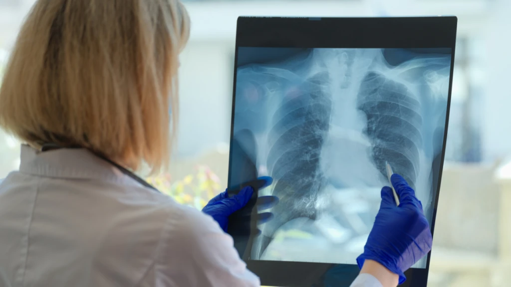 Koah nedir, neden olur? Koah hastalığının belirtileri, tanısı ve ...