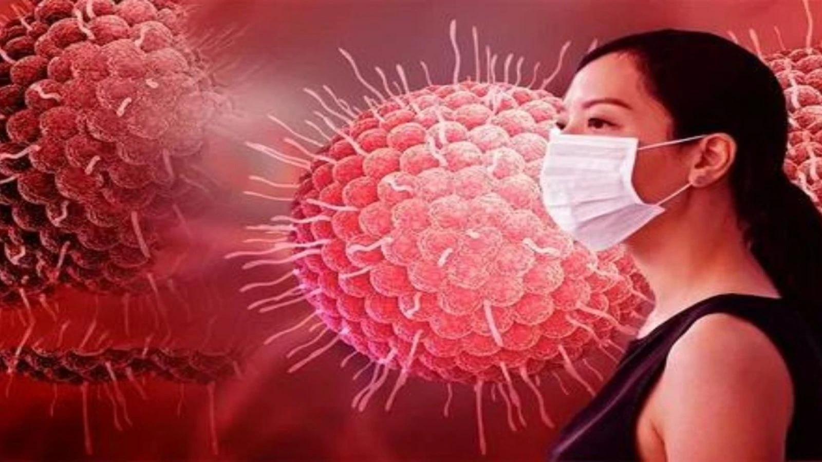 Domuz gribi nedir? Belirtileri neler? Evde doğal karışımlarla geçirmek ...