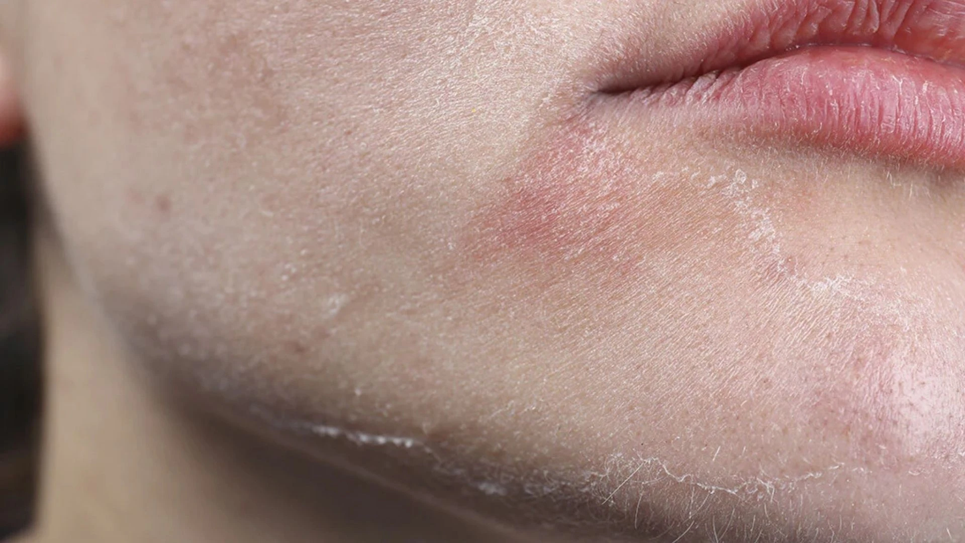 Kuru ciltleri pamuk gibi yapan krem! Evde bulundurmanız gereken 4 yağ ...